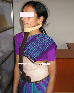 ORTHOTICS PROSTHETICS RESEARCH